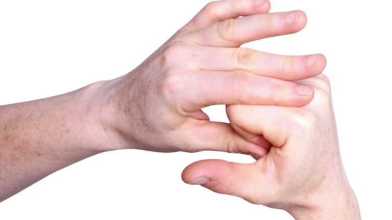 15 Physical Trigger Finger Exercises to Ease Pain and Stiffness - My ...